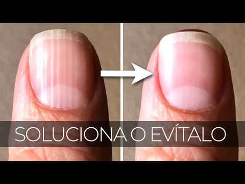 ¿Por qué desaparece la lunula de las uñas? Descubre las causas