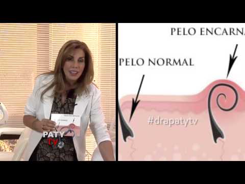 Pelo enquistado: causas, tratamiento y prevención